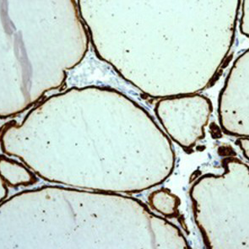 Tampa Thyroid Peroxidase Antibody Test - 24/7 Labs